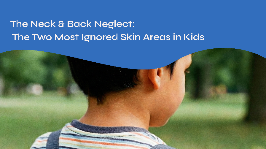 How to Prevent Dry Skin in Teens | Gentle Skincare Tips – Tikitoro